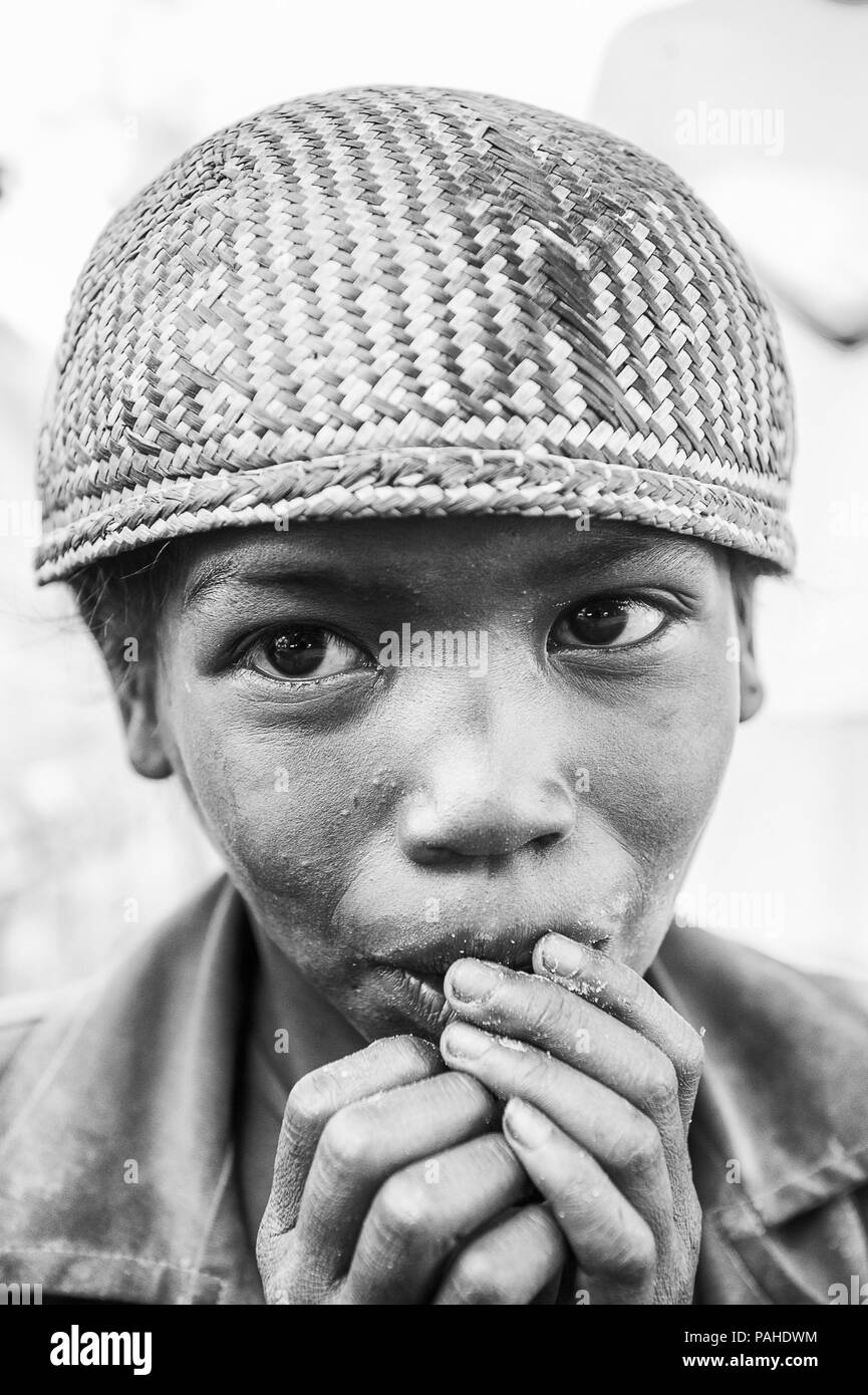 African skin woman bad face Black and White Stock Photos & Images - Alamy