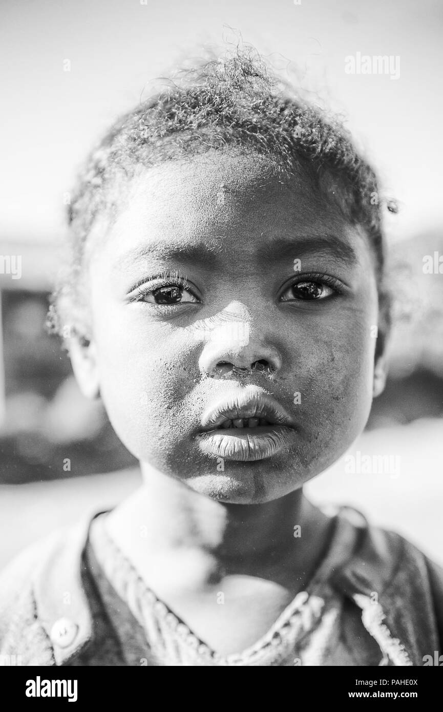MADAGASCAR - JULY 1, 2011: Portrait of an unidentified cute little girl ...