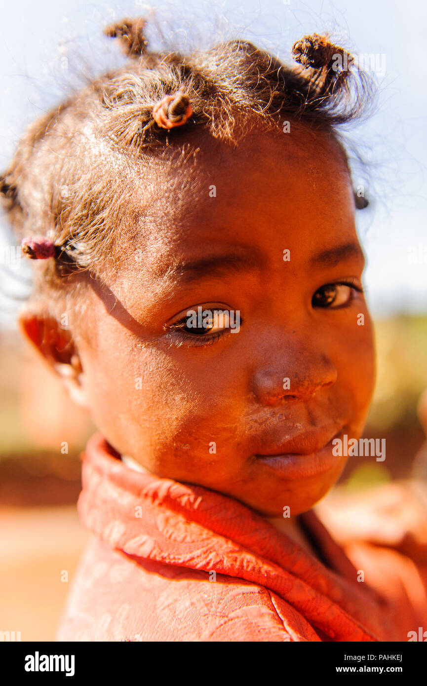 MADAGASCAR - JULY 1, 2011: Portrait of an unidentified cute little girl ...