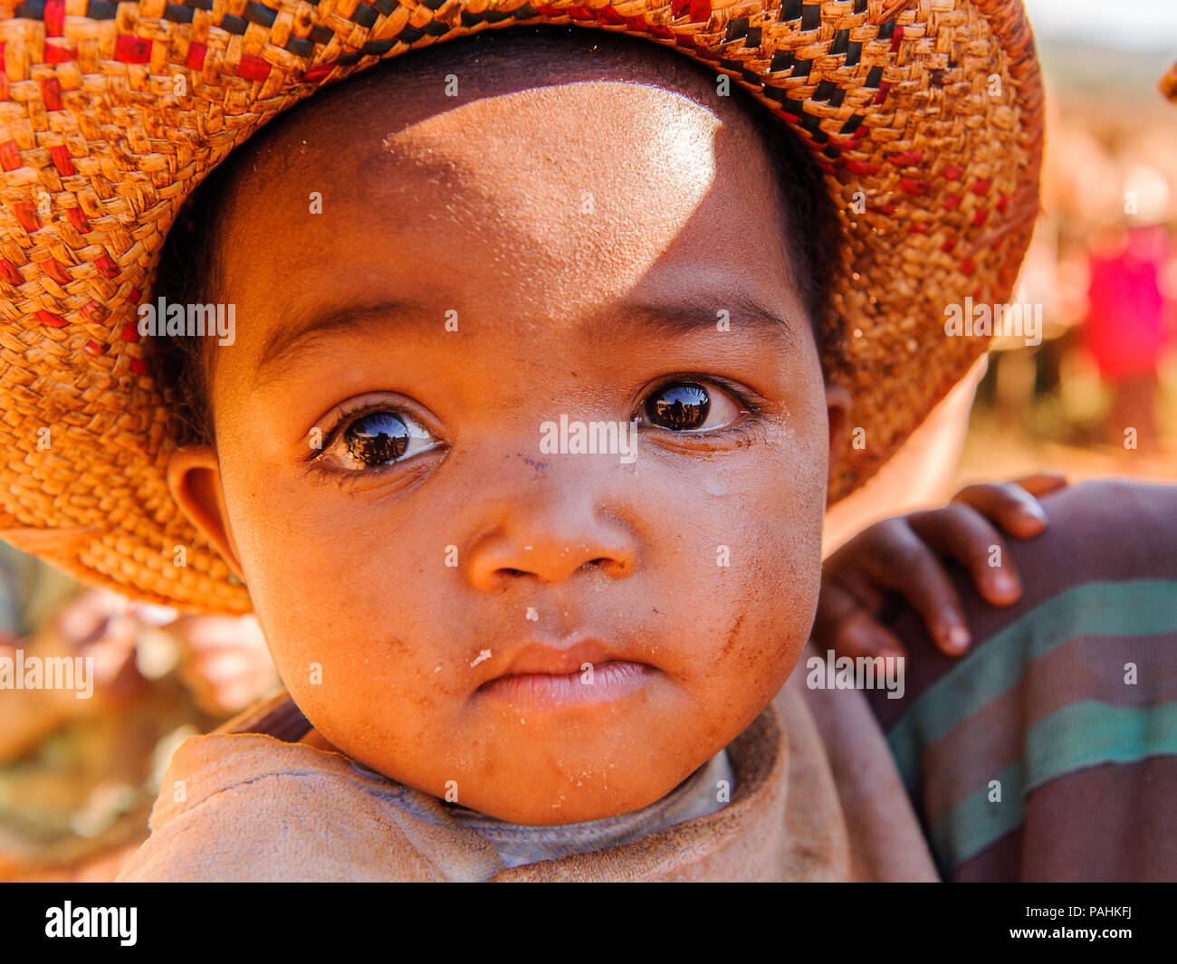 MADAGASCAR - JULY 1, 2011: Portrait of an unidentified little baby girl ...