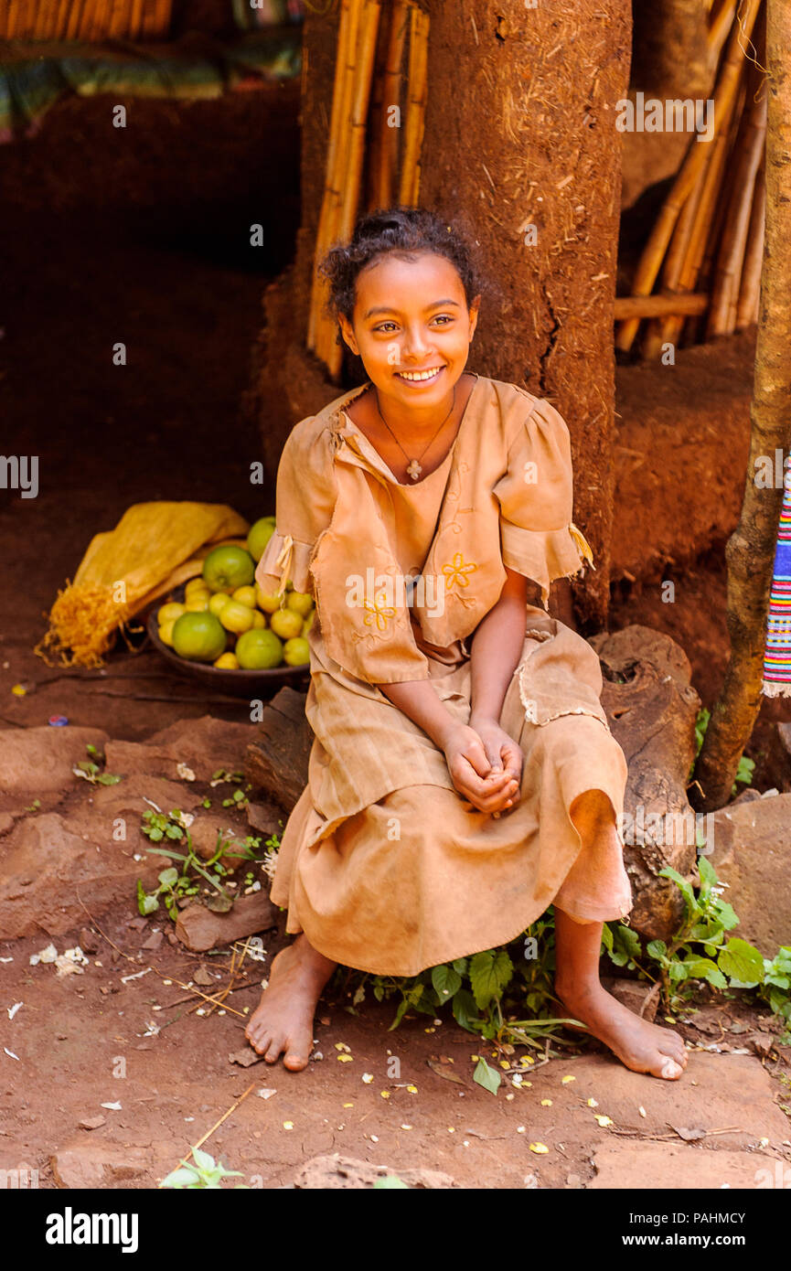 Beautiful Ethiopian People Meron Benti, An Ethiopian Albino: «I Know