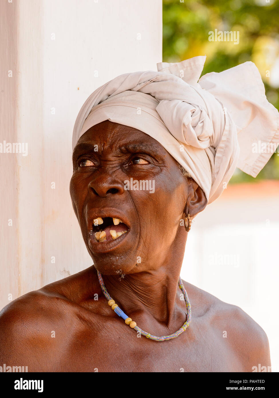 Toothless people hi-res stock photography and images - Alamy