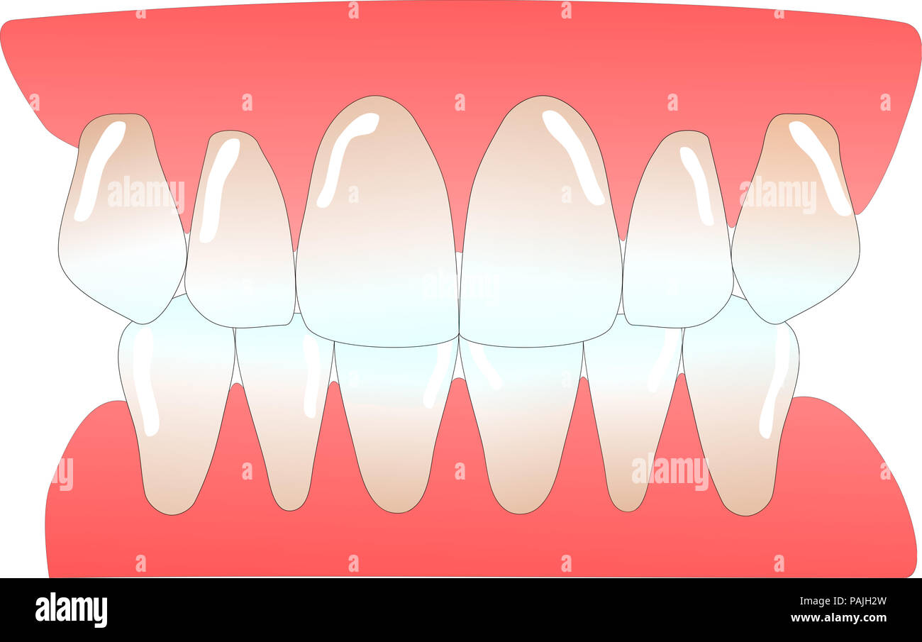 illustration of vital front teeth Stock Photo - Alamy
