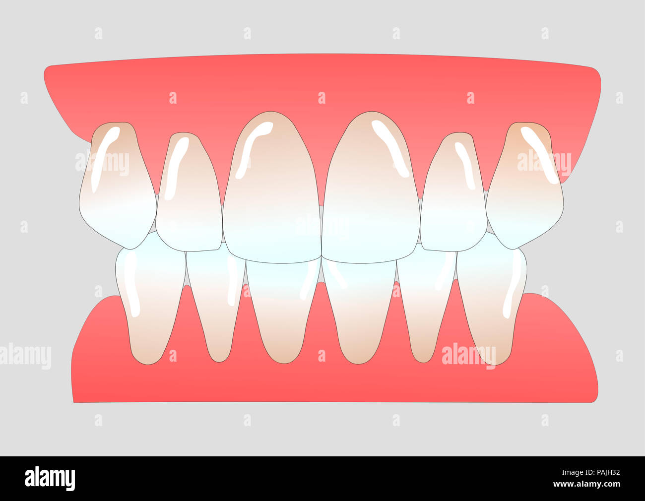 illustration of vital front teeth Stock Photo - Alamy