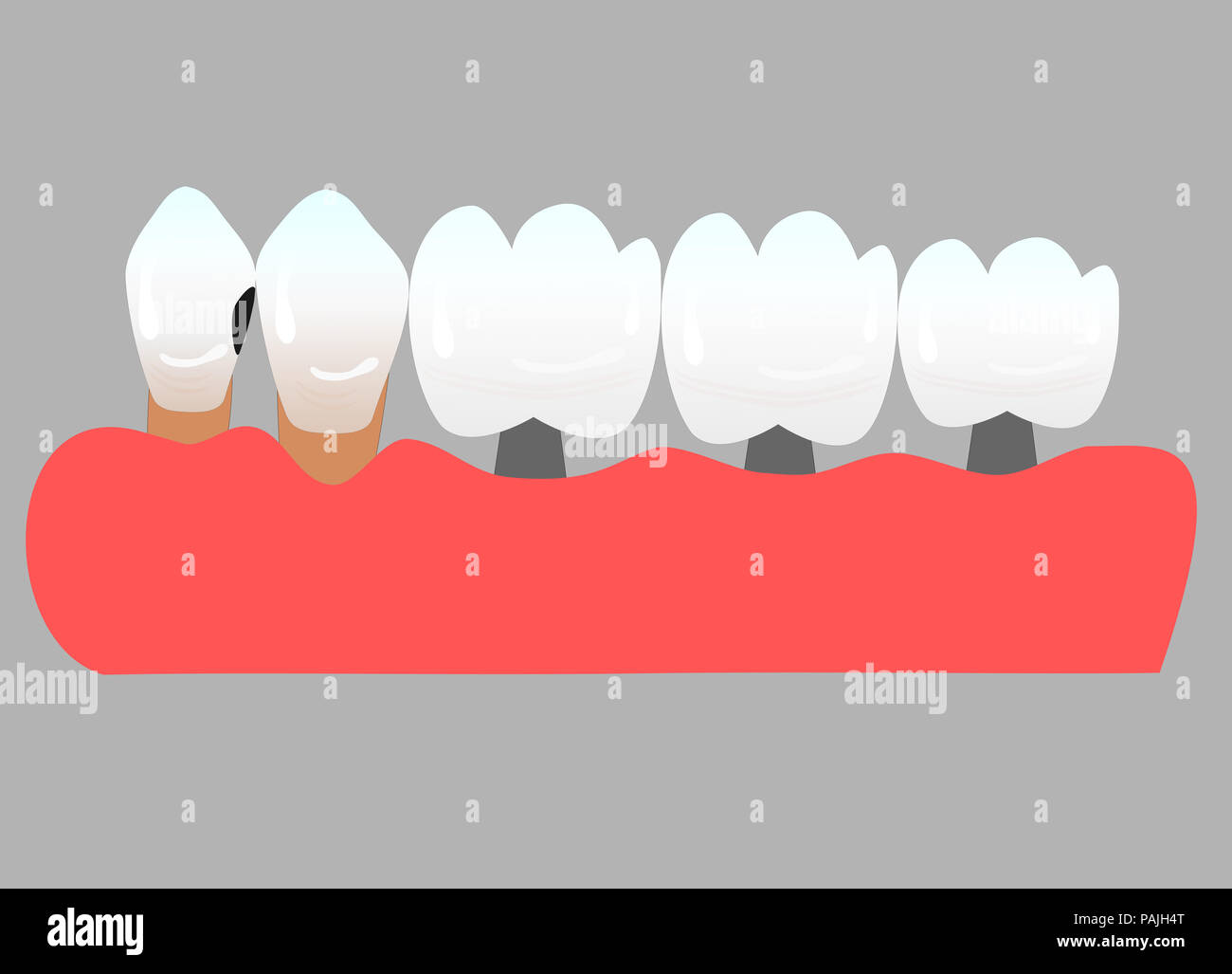 illustration od side teeth Stock Photo - Alamy