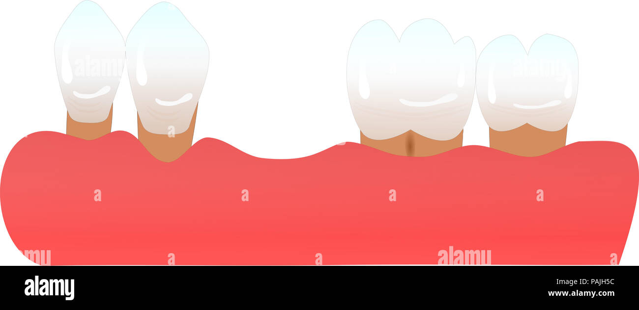 illustration of side teeth Stock Photo - Alamy