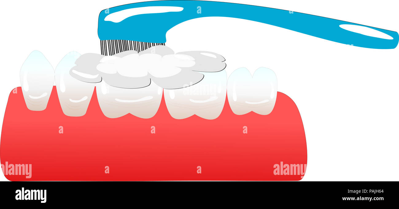 Marginal periodontitis hi-res stock photography and images - Alamy