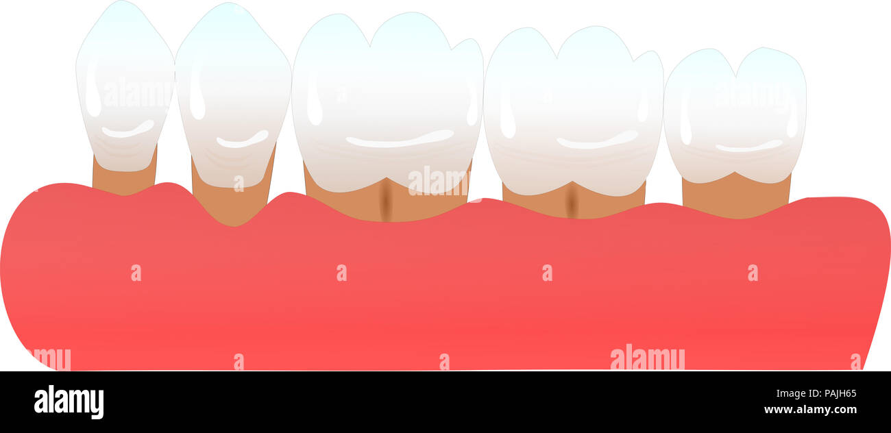 illustration of side teeth Stock Photo - Alamy