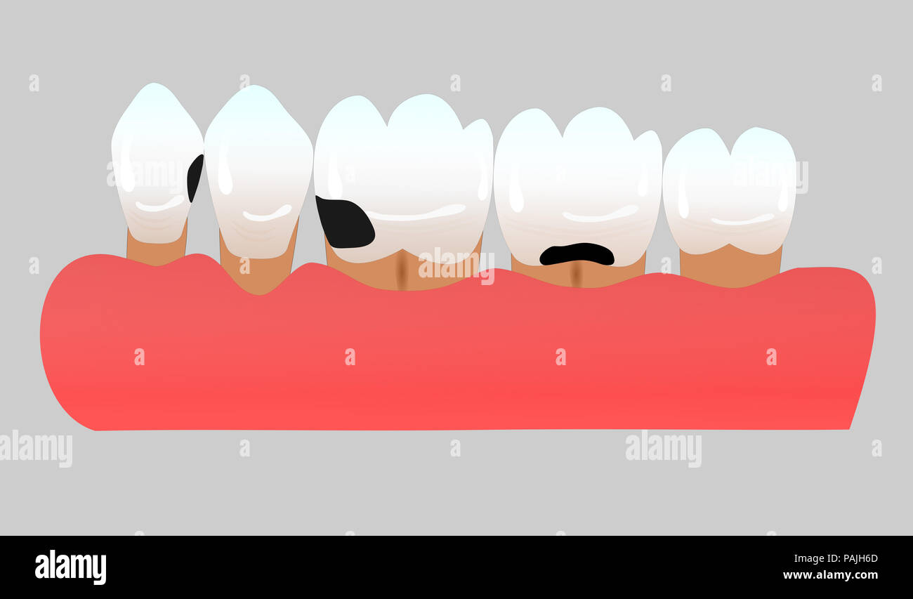 illustration of side teeth Stock Photo - Alamy