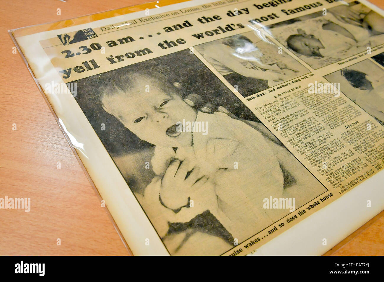 First Test Tube Baby Louise Brown 1978