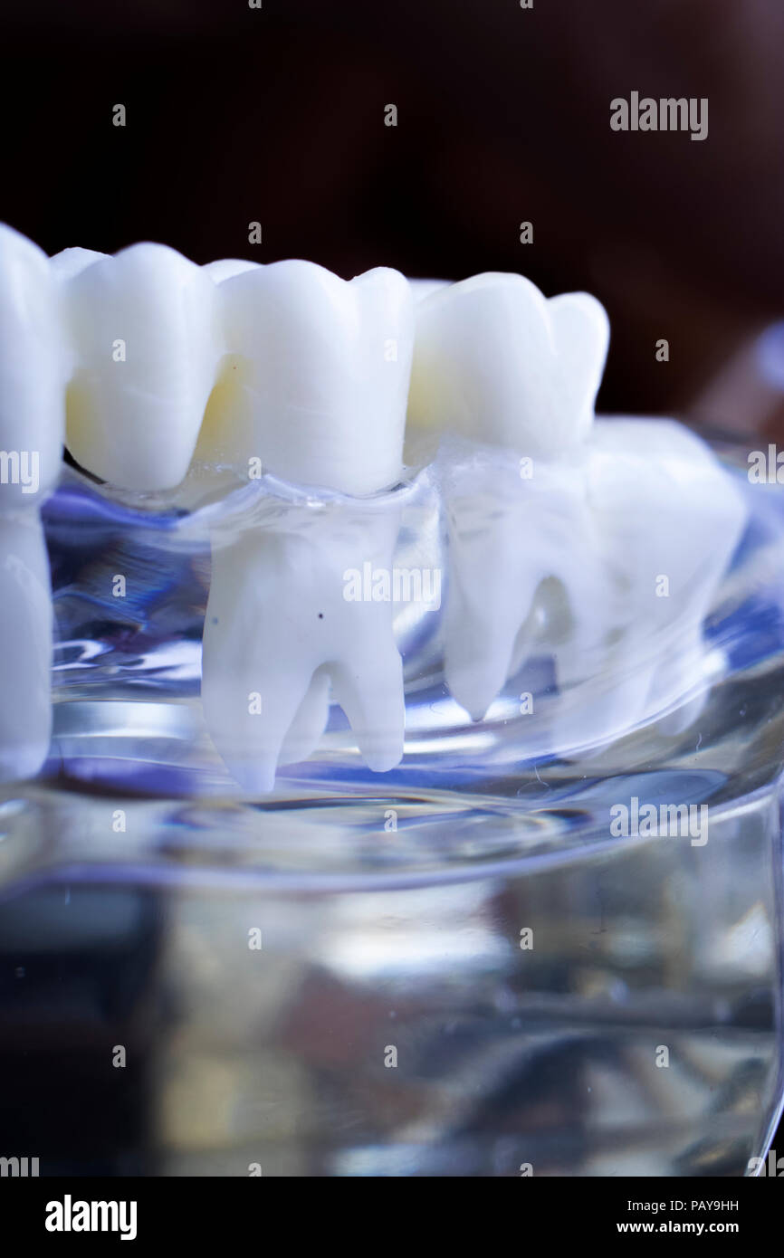 Dentist dental teeth teaching model showing each tooth and gum for ...