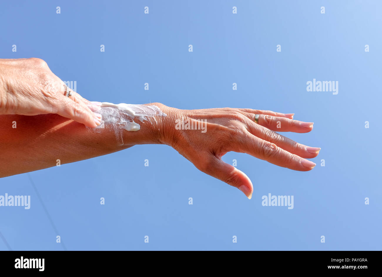 Sun damage arms hi-res stock photography and images - Alamy