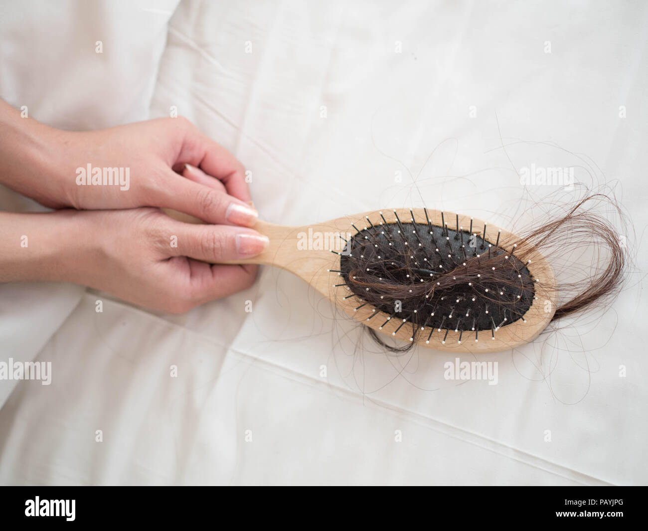 hair loss problem Stock Photo - Alamy