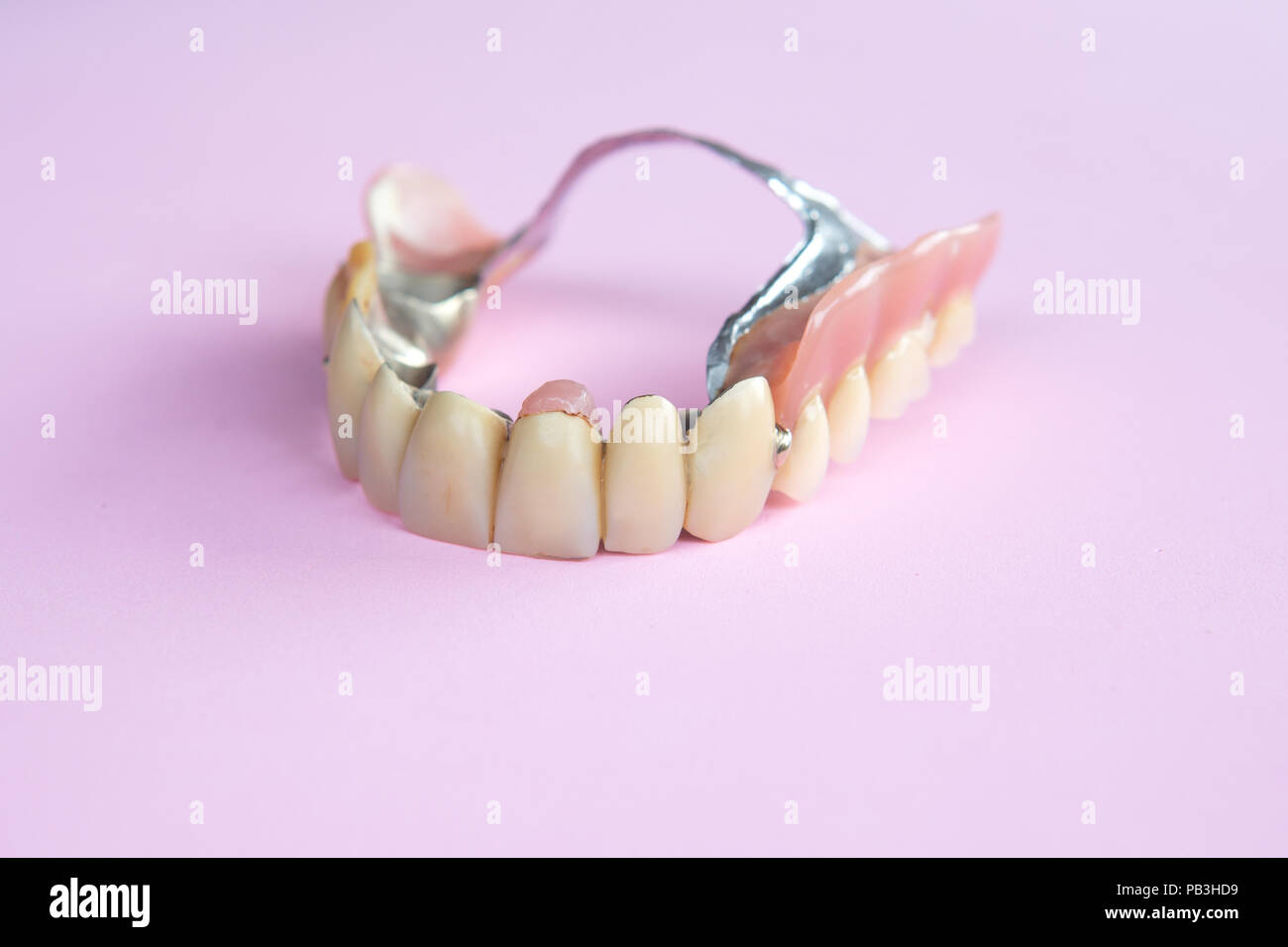 Acrylic prosthesis hi-res stock photography and images - Alamy