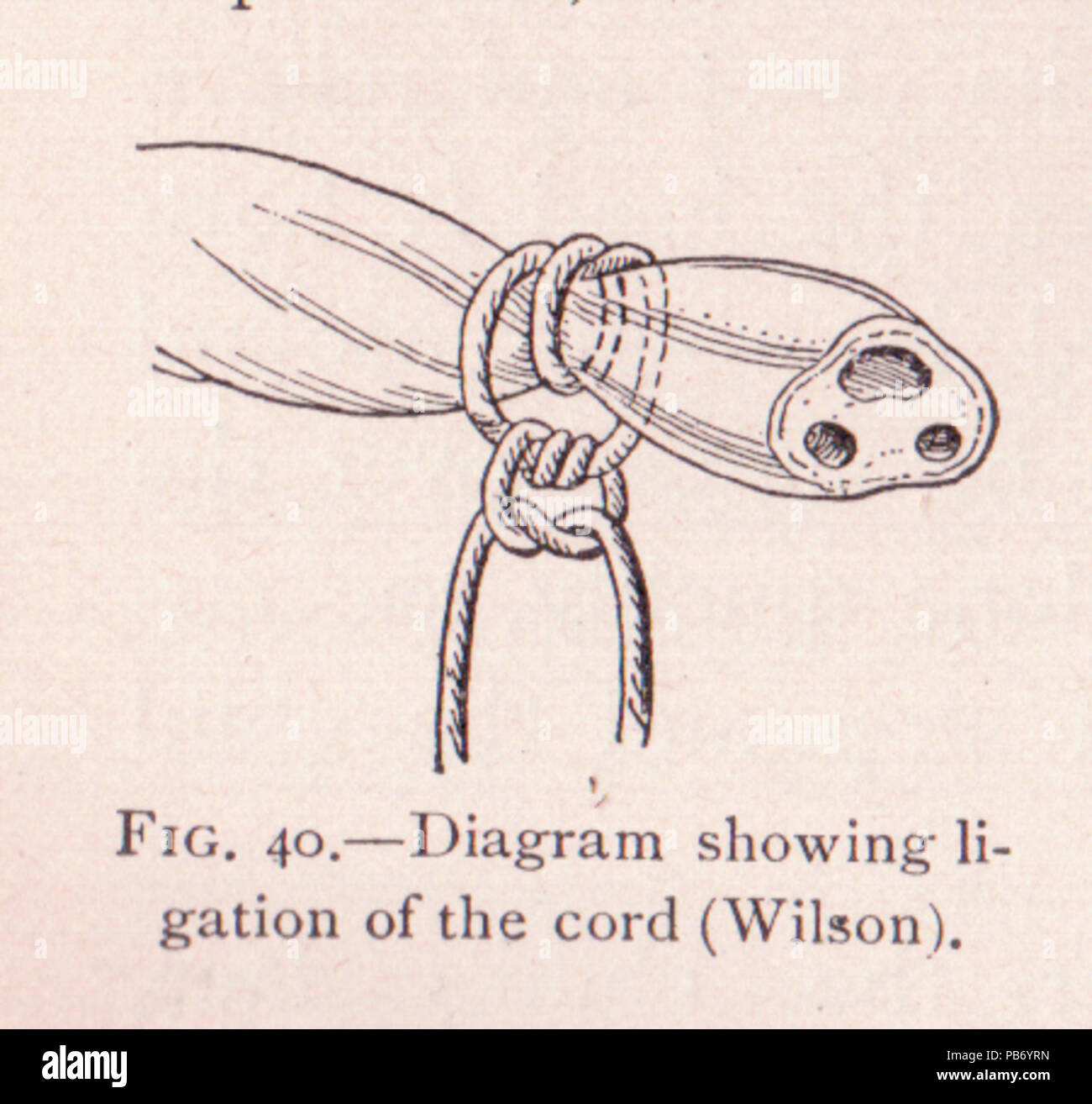 Umbilical cord anatomy hi-res stock photography and images - Alamy