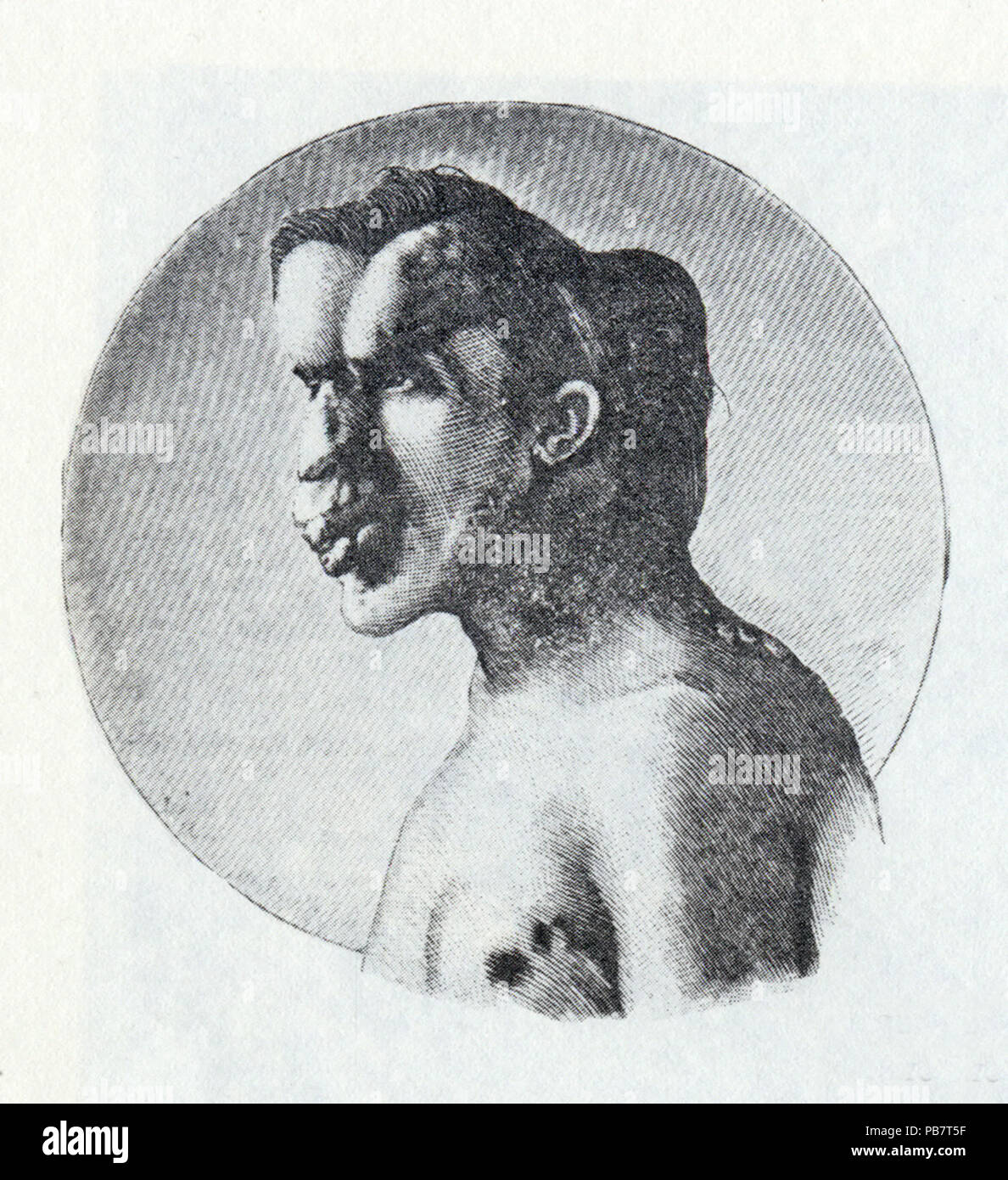 Joseph merrick hi-res stock photography and images - Alamy