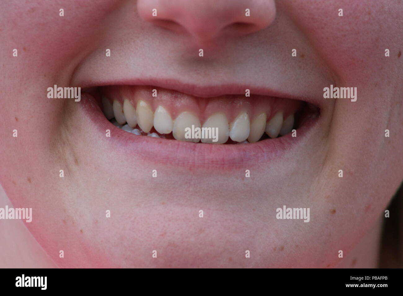 closeup of smile with white healthy teeth Stock Photo - Alamy