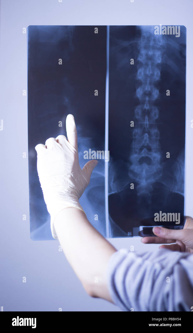 Medical hospital x-ray lowe back pain spine and hips traumatology scan ...