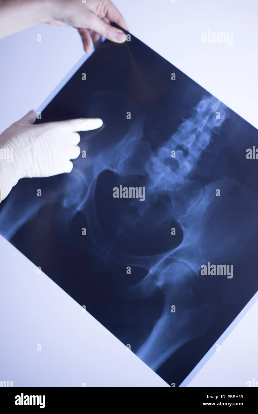 Medical hospital x-ray lowe back pain spine and hips traumatology scan ...