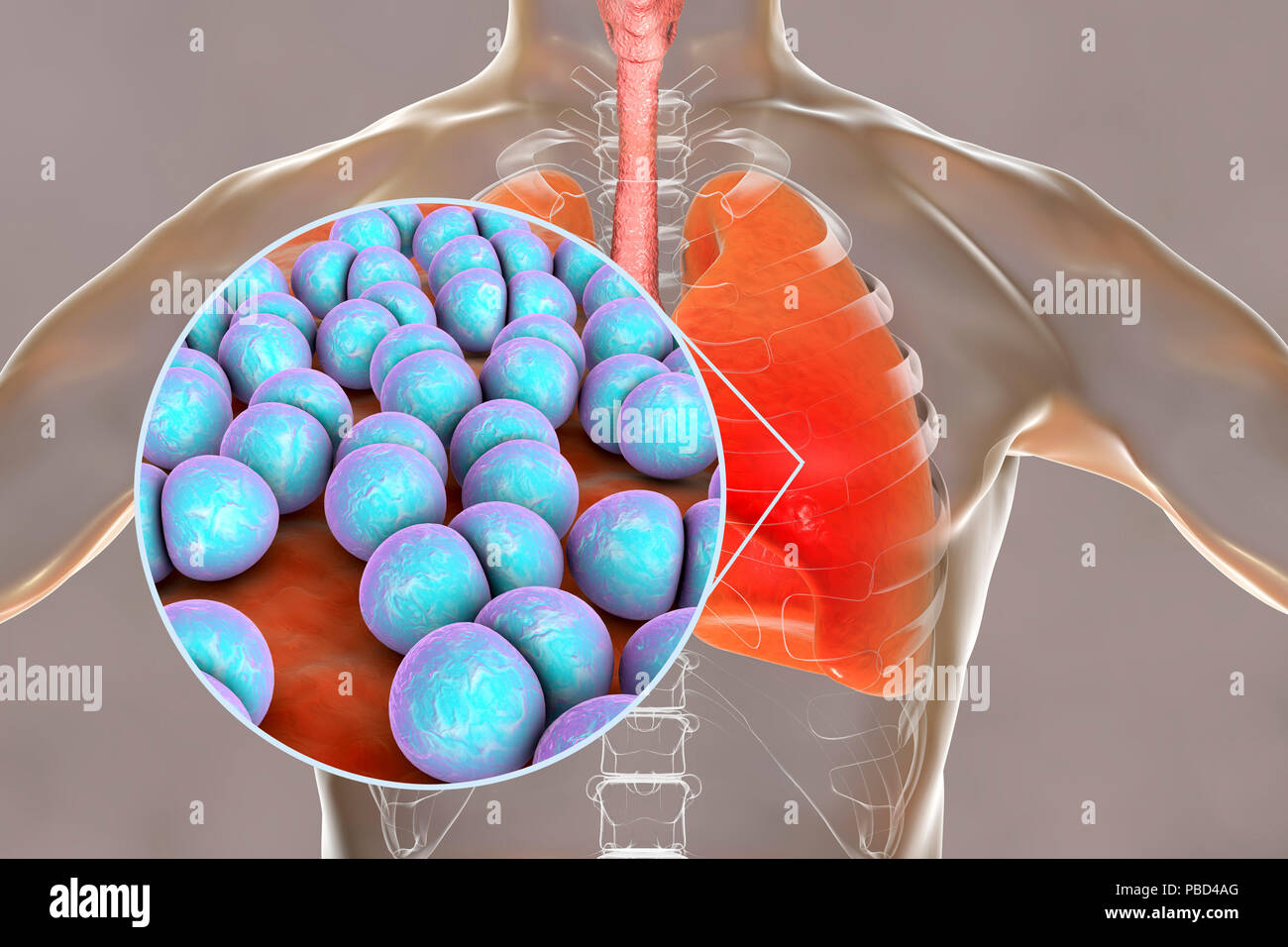 Diplococci bacteria hi-res stock photography and images - Alamy