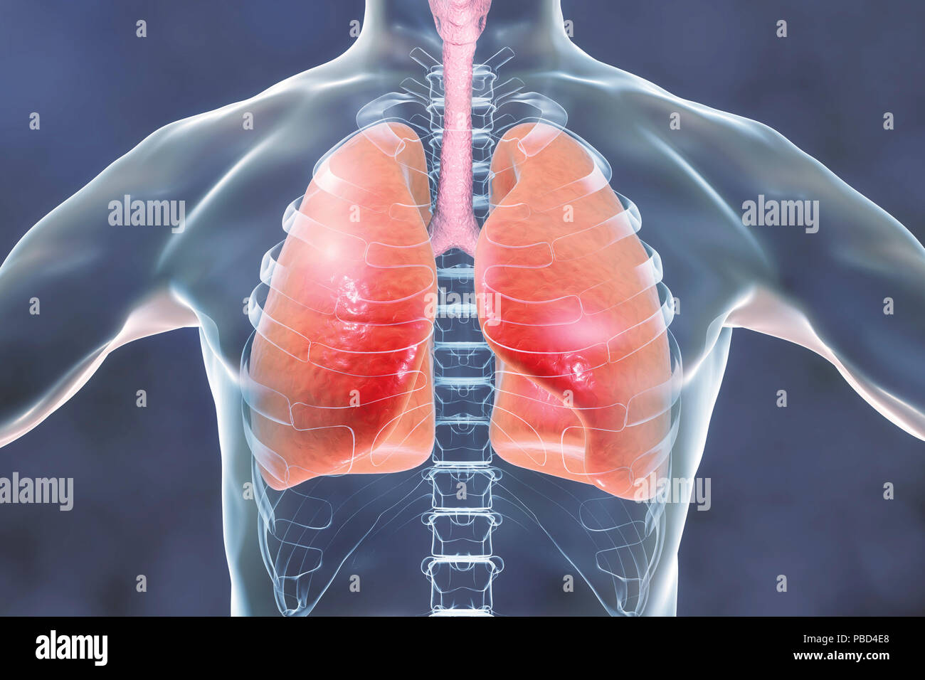 Human lungs, computer illustration Stock Photo - Alamy