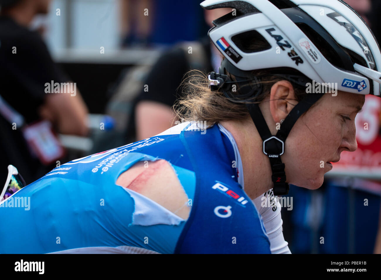 Road rash hi-res stock photography and images - Alamy