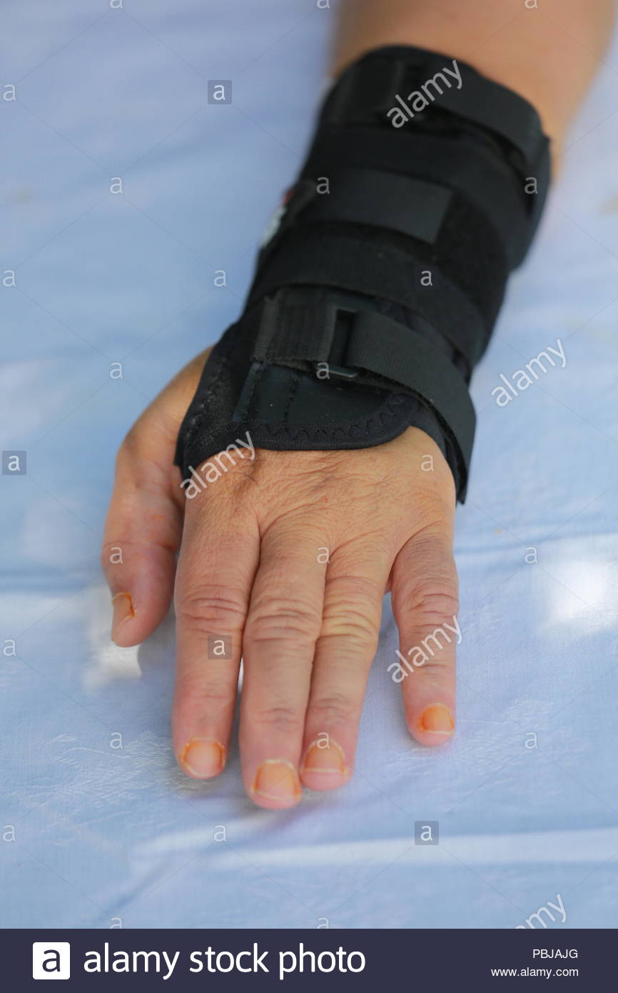 Broken wrist hi-res stock photography and images - Alamy