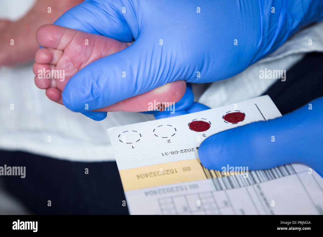 Newborn / new born baby undergoes neonatal heel prick screening ...
