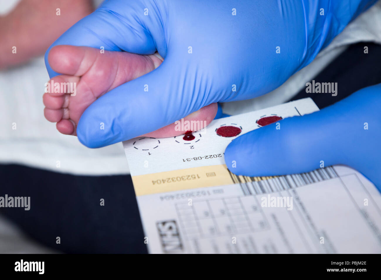 Newborn / new born baby undergoes neonatal heel prick screening ...
