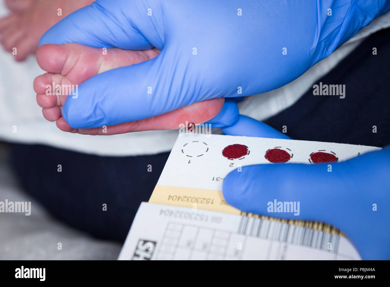Newborn / new born baby undergoes neonatal heel prick screening ...
