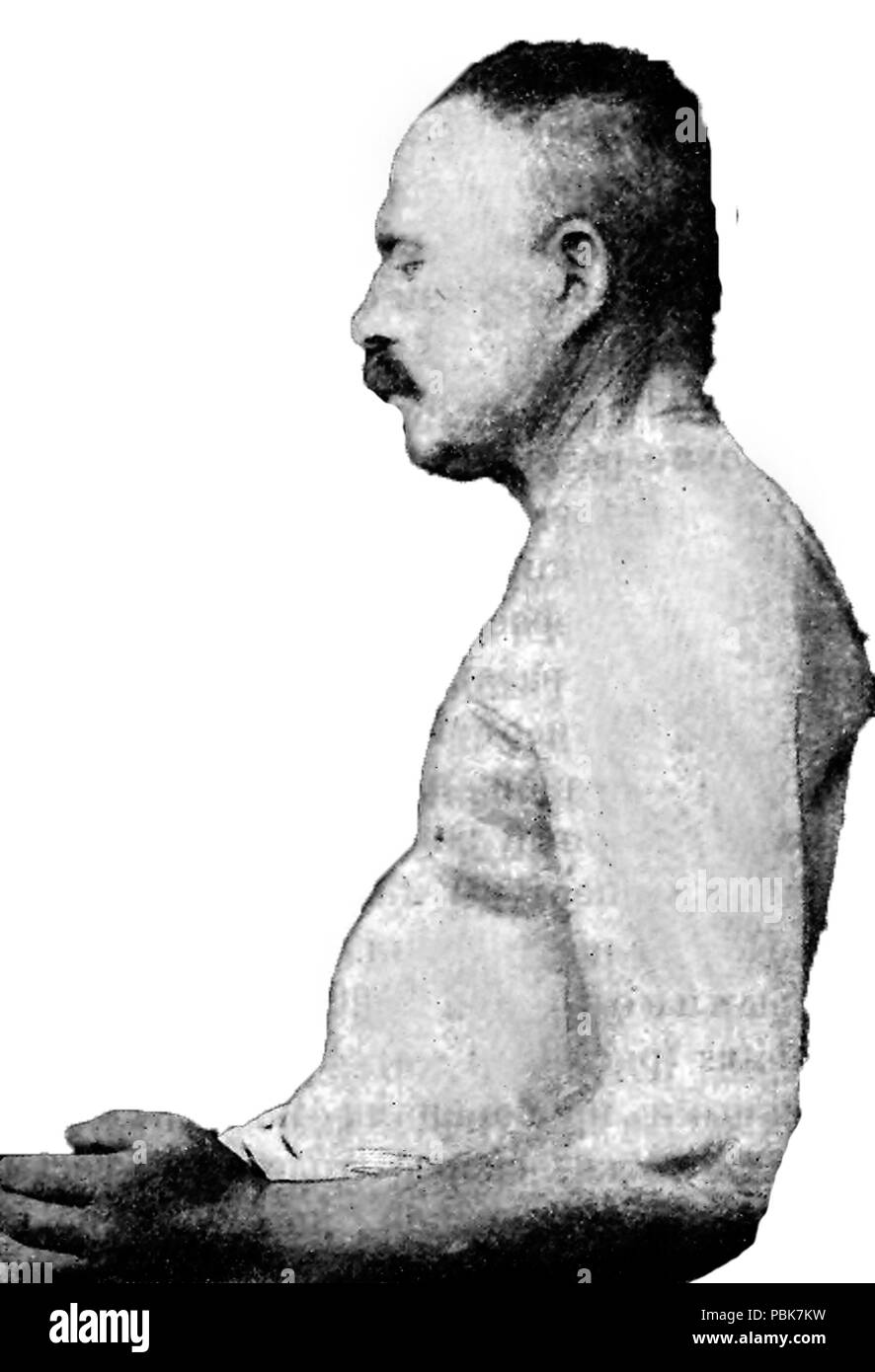 1238 Pyknic-Circular. Profile Stock Photo - Alamy