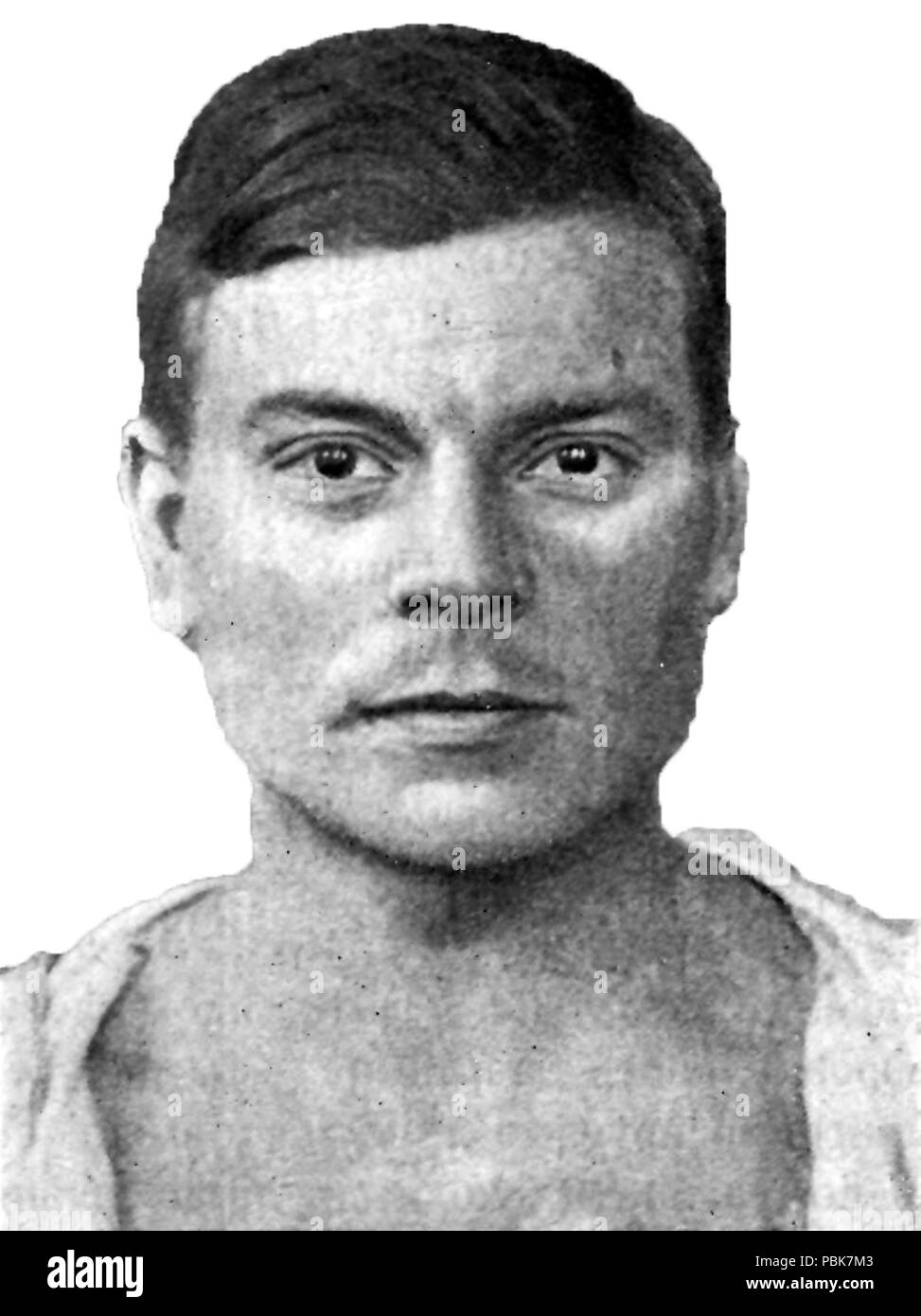 1879 Young pyknic type, age. 20. Endogenous depression Stock Photo - Alamy