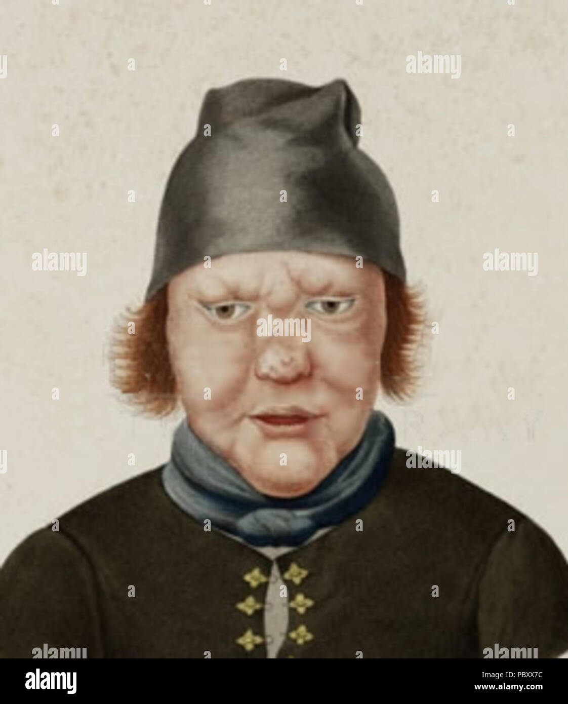 Leper care hi-res stock photography and images - Alamy