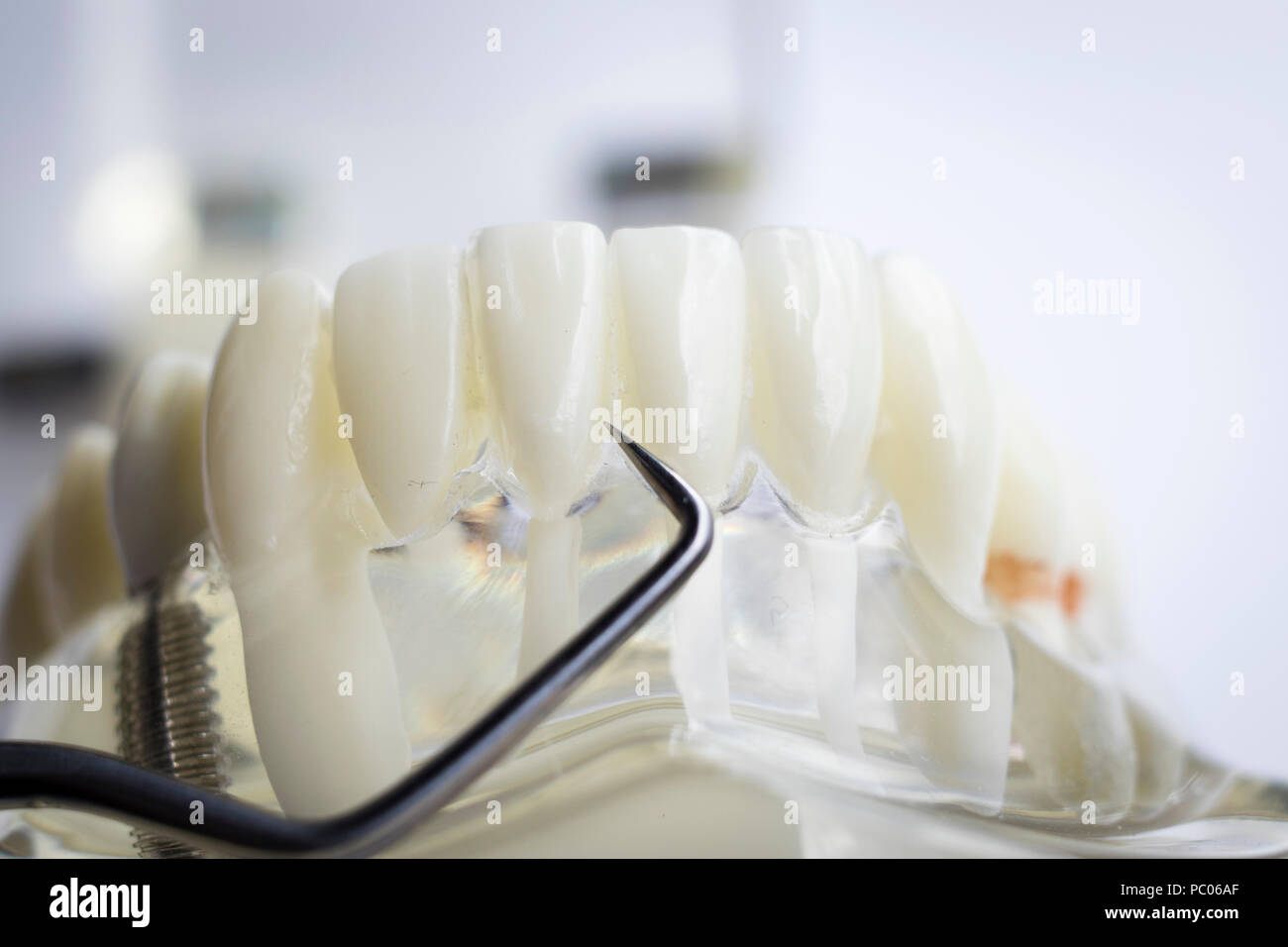 Dentist cleaning teeth with titanium metal tooth pick instrument to ...