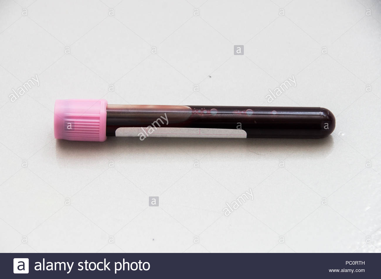 White Blood Cell Stock Photos & White Blood Cell Stock Images - Alamy