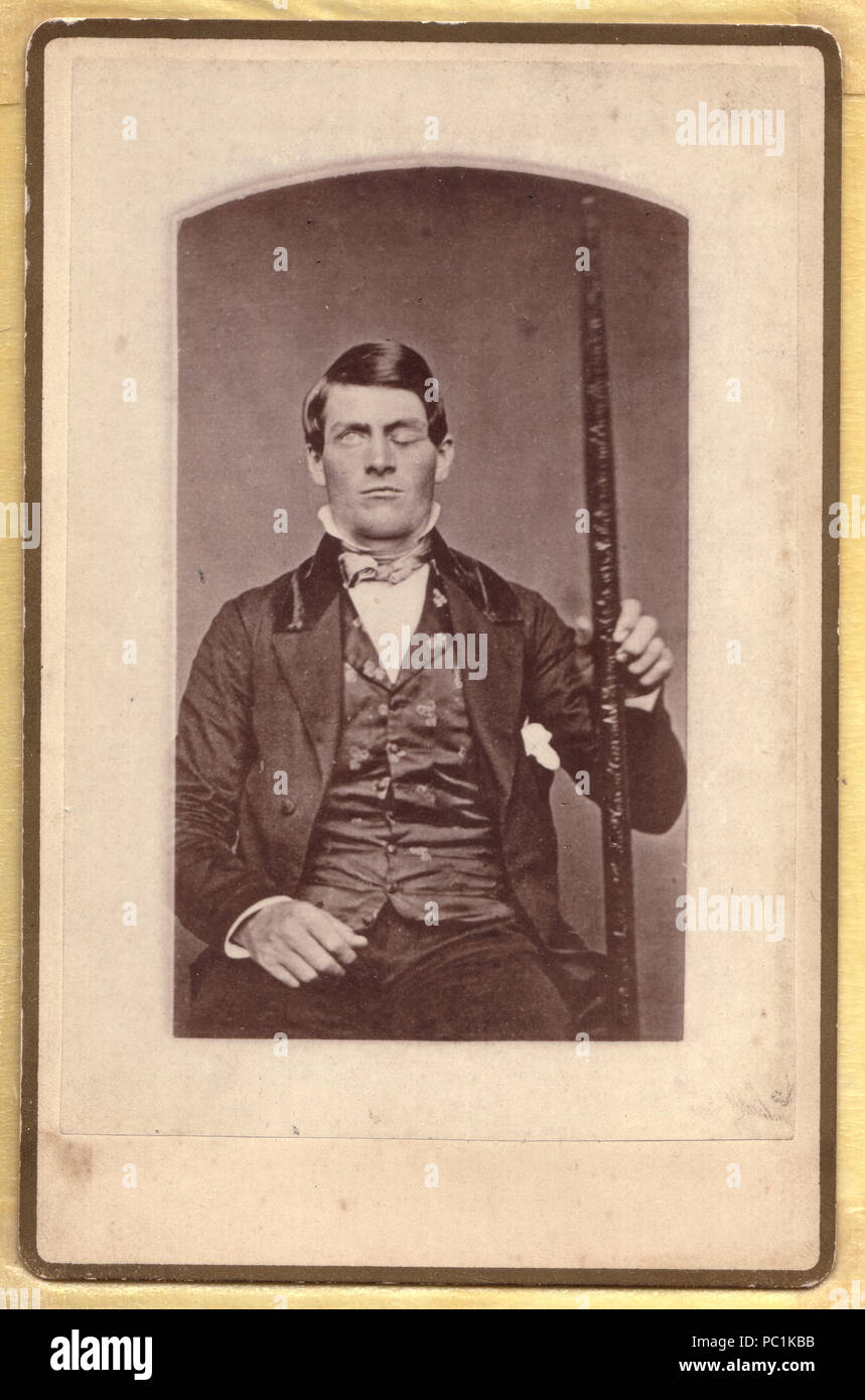 481 Phineas Gage GageMillerPhoto2010-02-17 Unretouched Color Stock ...