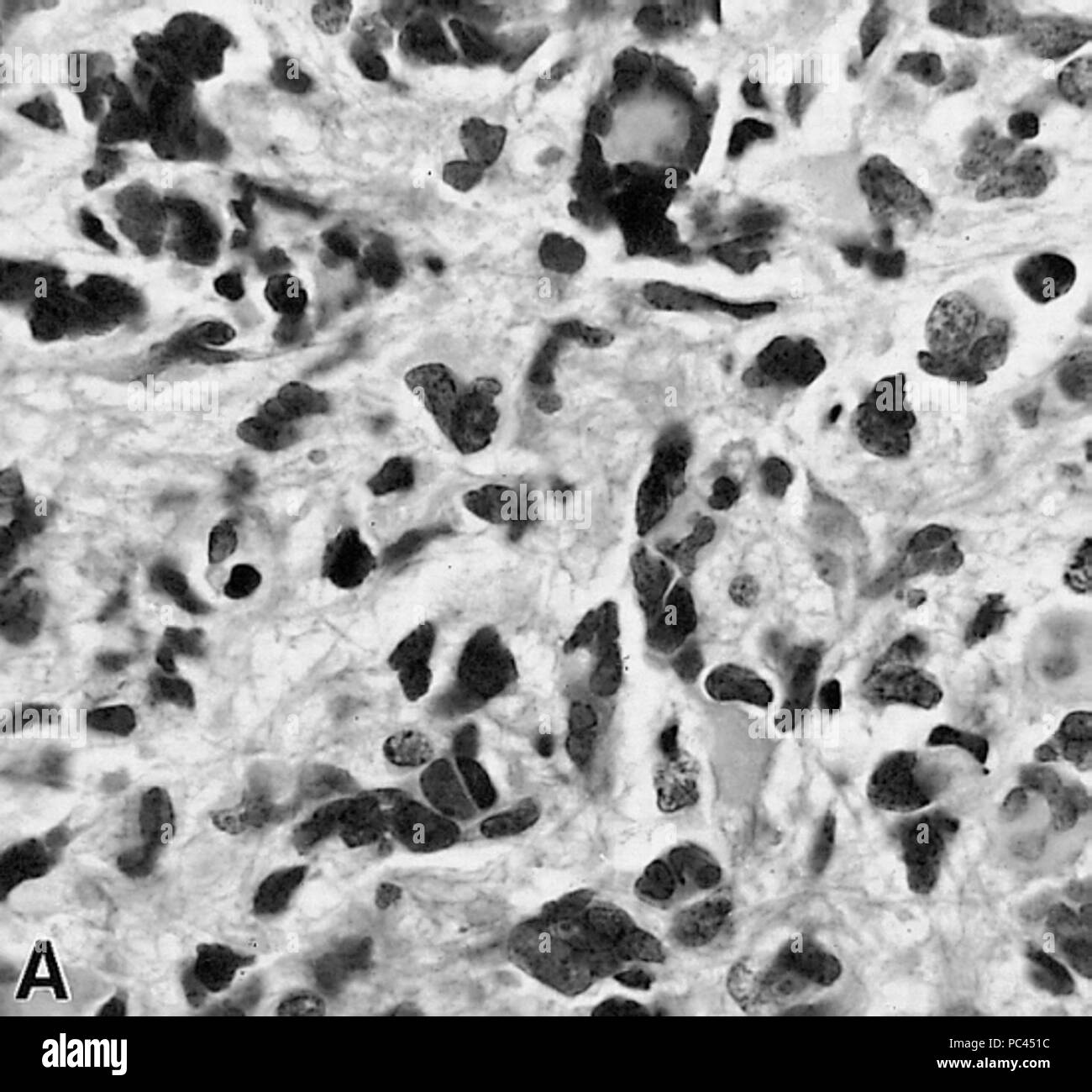 Micro photo Black and White Stock Photos & Images - Alamy