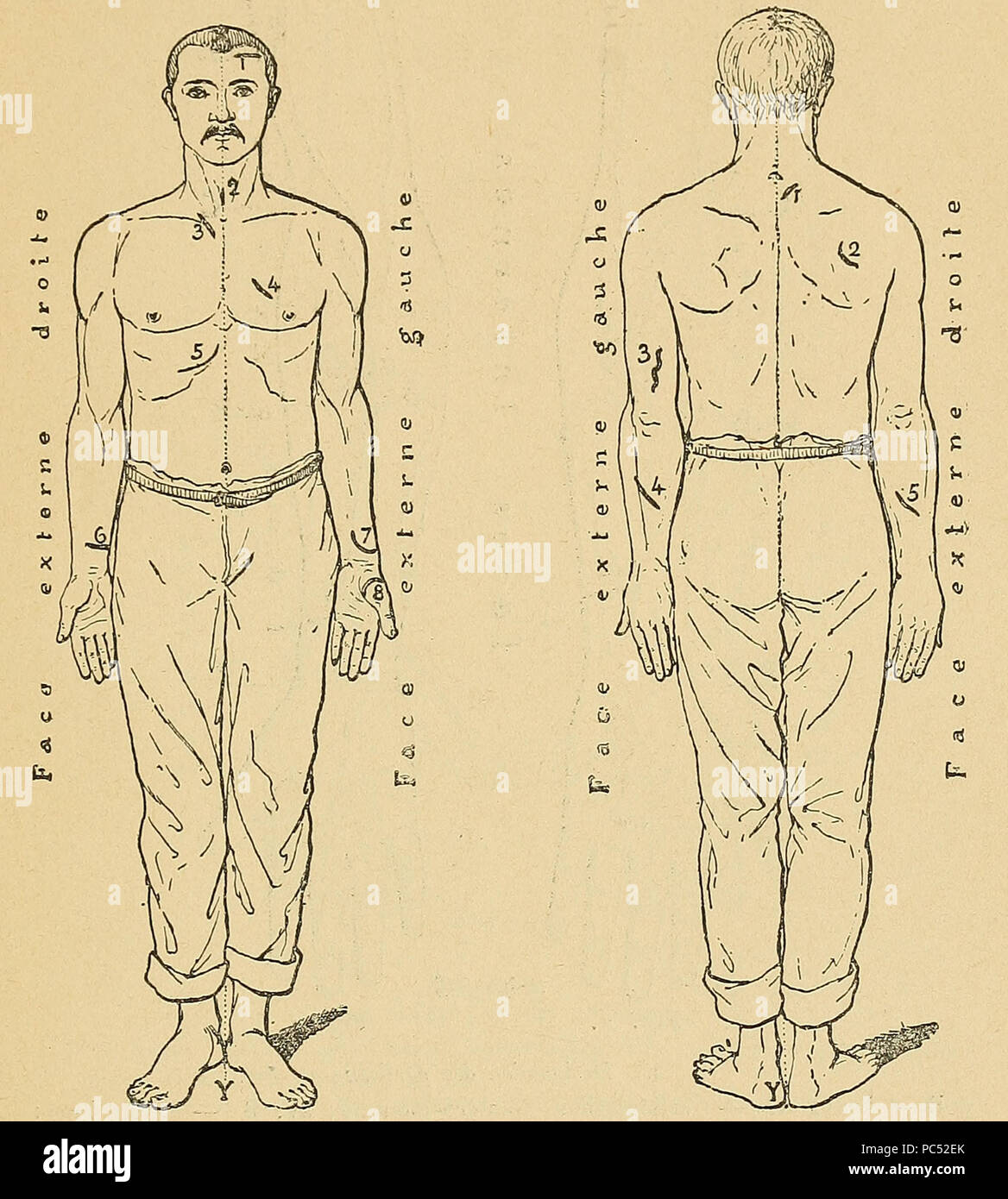 14 Bertillon - Identification anthropométrique (1893) 349 Stock Photo ...