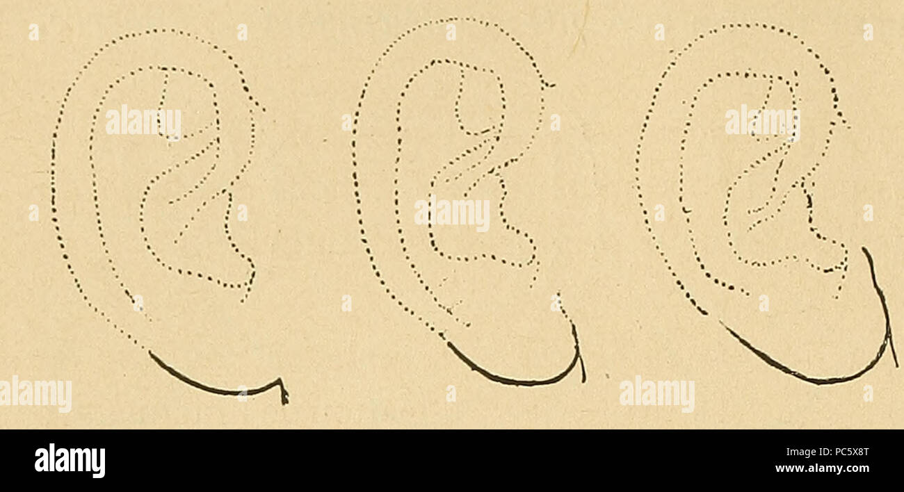 13 Bertillon - Identification anthropométrique (1893) 062.1 Stock Photo ...