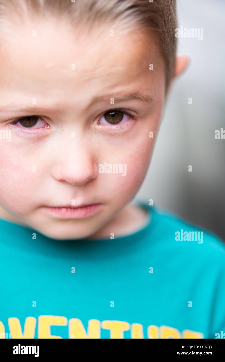 Boy Closeup Face Tear High Resolution Stock Photography and Images - Alamy