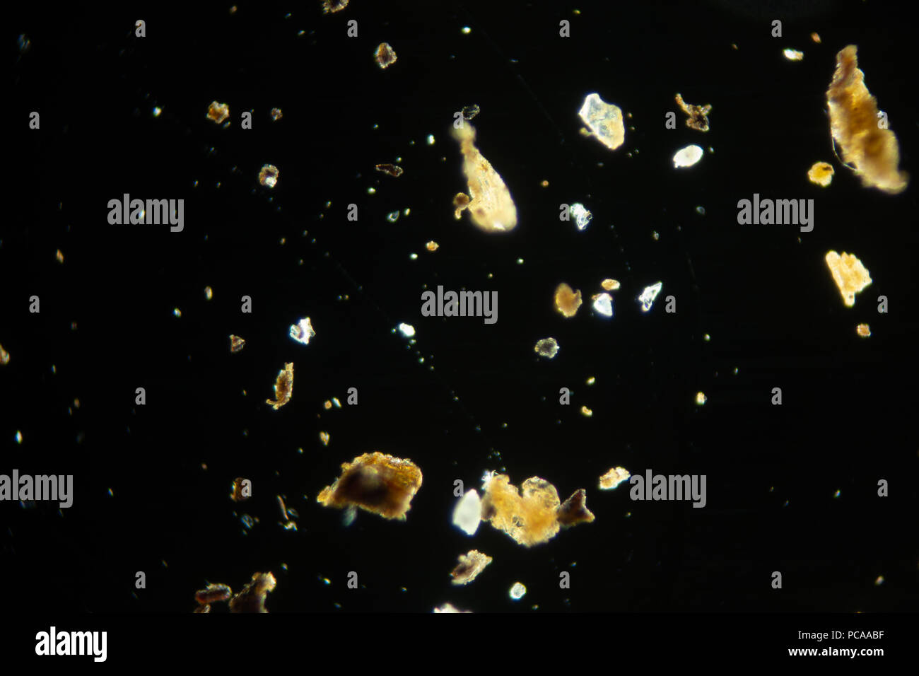 house dust in the microscope Stock Photo - Alamy