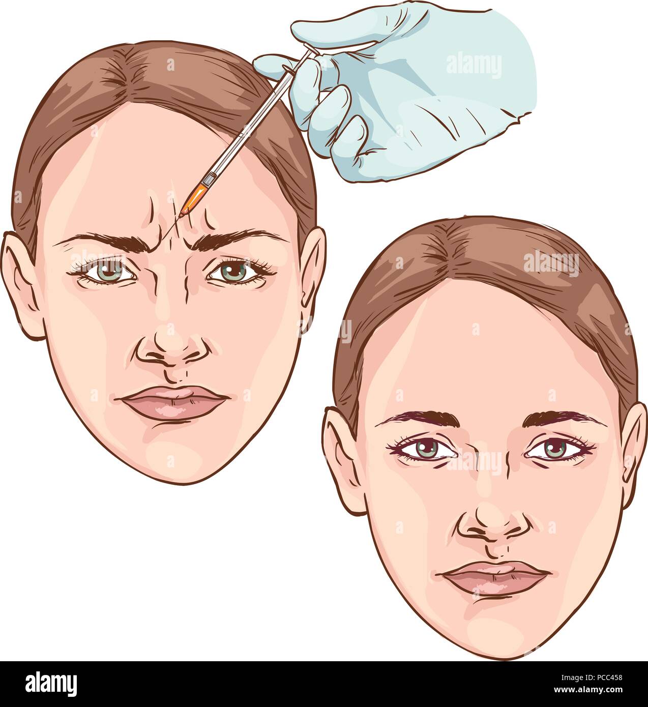 Facial rejuvenation vector vectors Stock Vector Images - Alamy