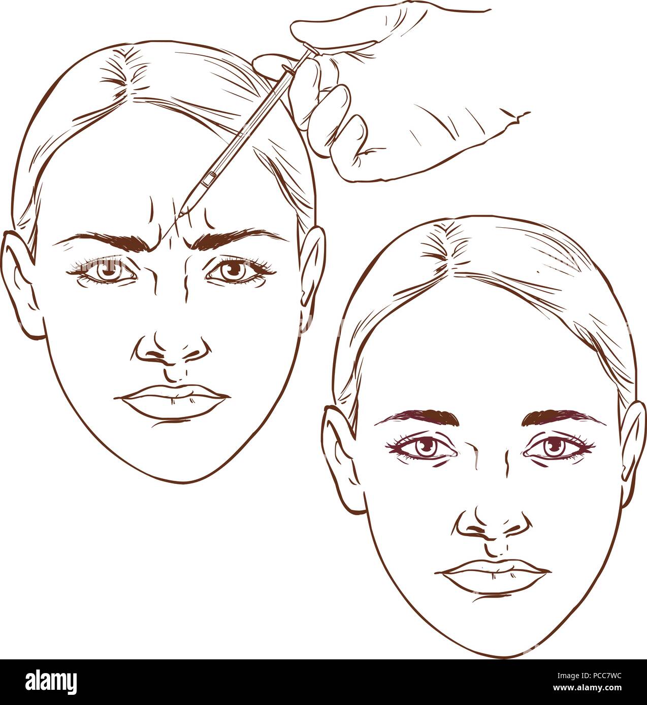 Wrinkles on the forehead. rejuvenation. plastic surgery Stock Vector ...