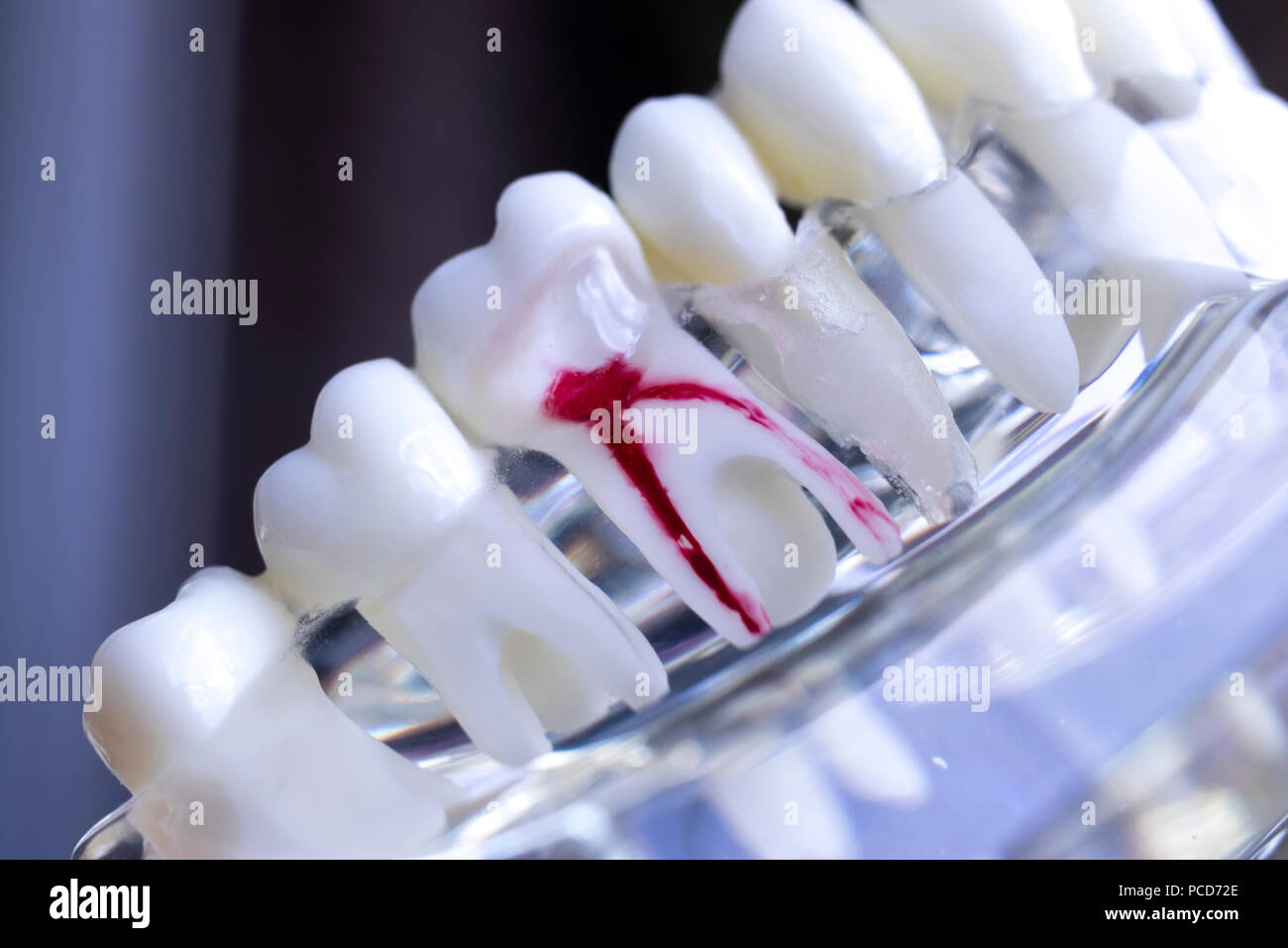 Dentist dental teeth teaching model showing each tooth and gum for ...