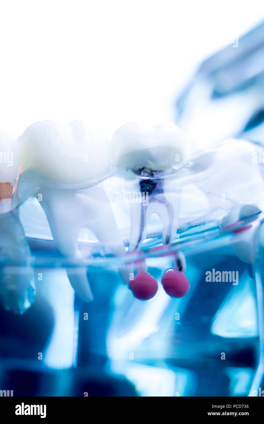 Dentist dental teeth teaching model showing each tooth and gum for ...
