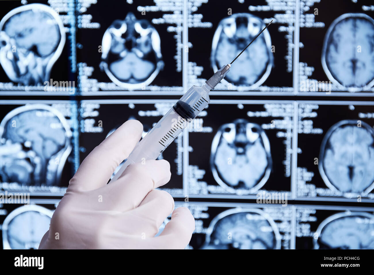 Magnetic resonance scan of the brain. MRI. Syringe in hand Stock Photo ...