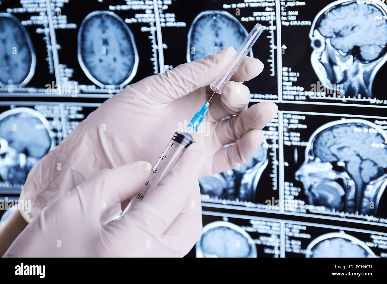 Magnetic resonance scan of the brain. MRI. Syringe in hand Stock Photo ...