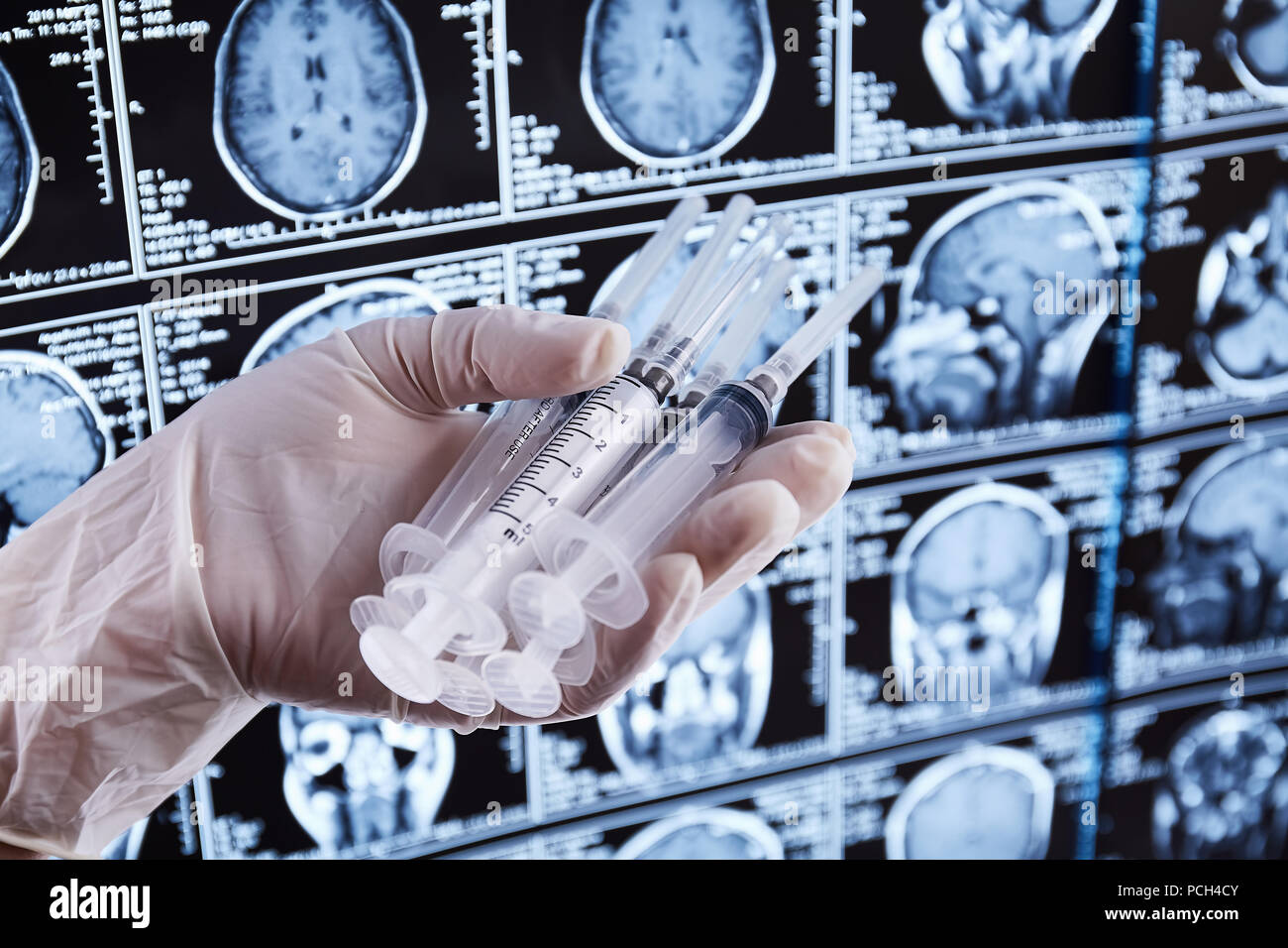 Magnetic resonance scan of the brain. MRI. Syringe in hand Stock Photo ...