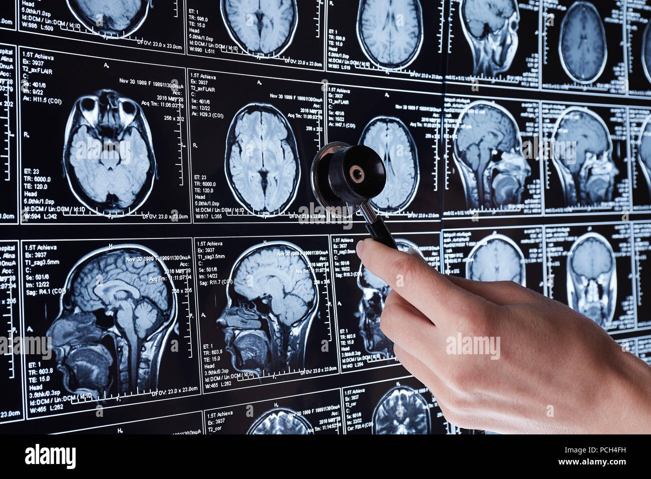 Magnetic resonance scan of the brain. MRI head scan Stock Photo - Alamy