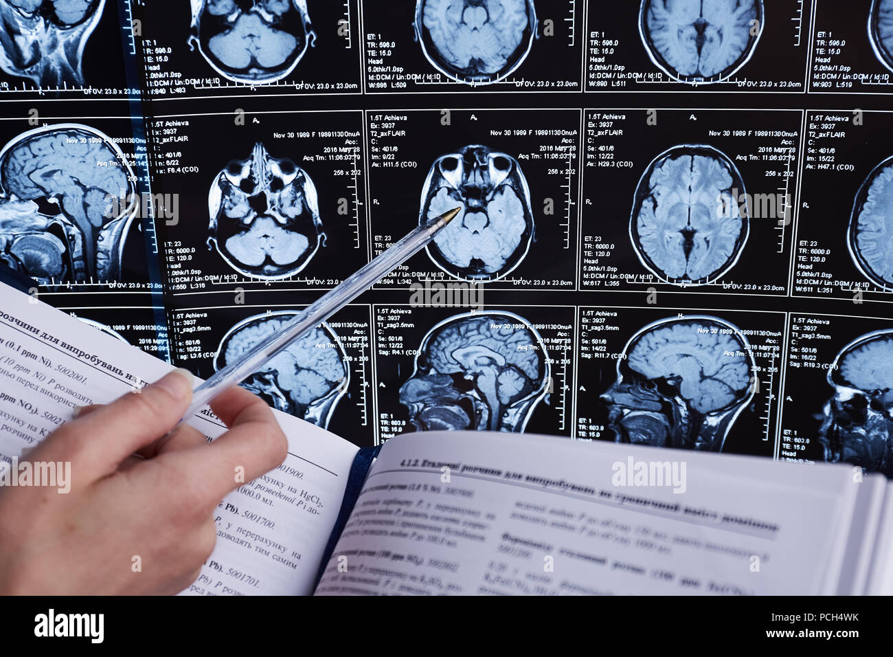 Magnetic resonance scan of the brain. MRI head scan Stock Photo - Alamy